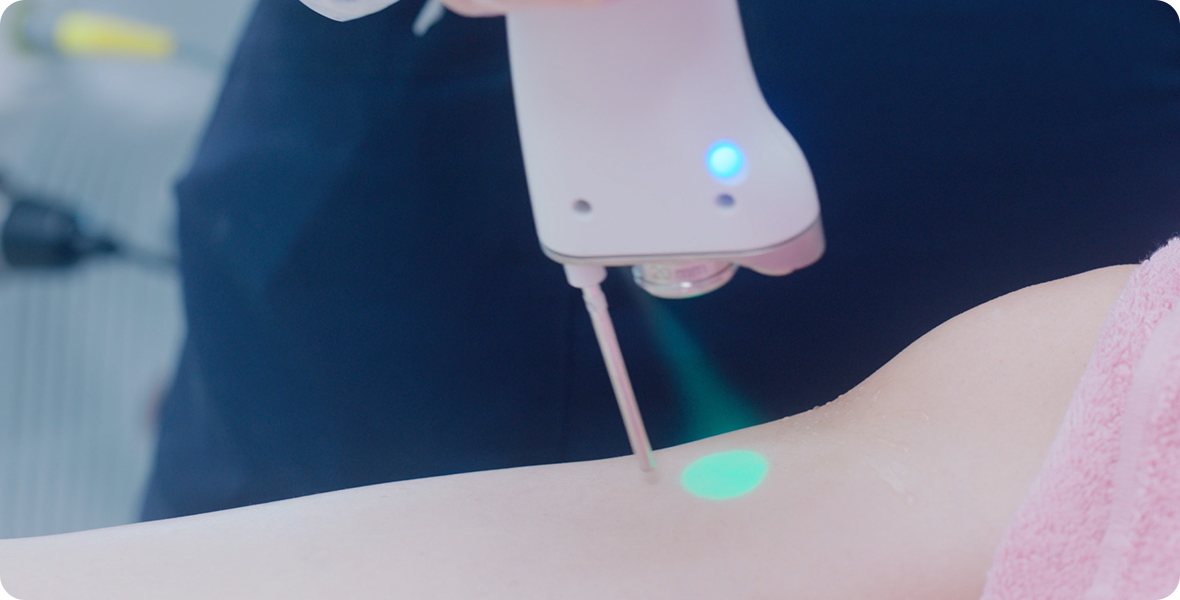 ミスト脱毛® AvalancheLase（アバランチレイズ）｜医療脱毛・医療レーザー脱毛なら湘南美容クリニック【公式】